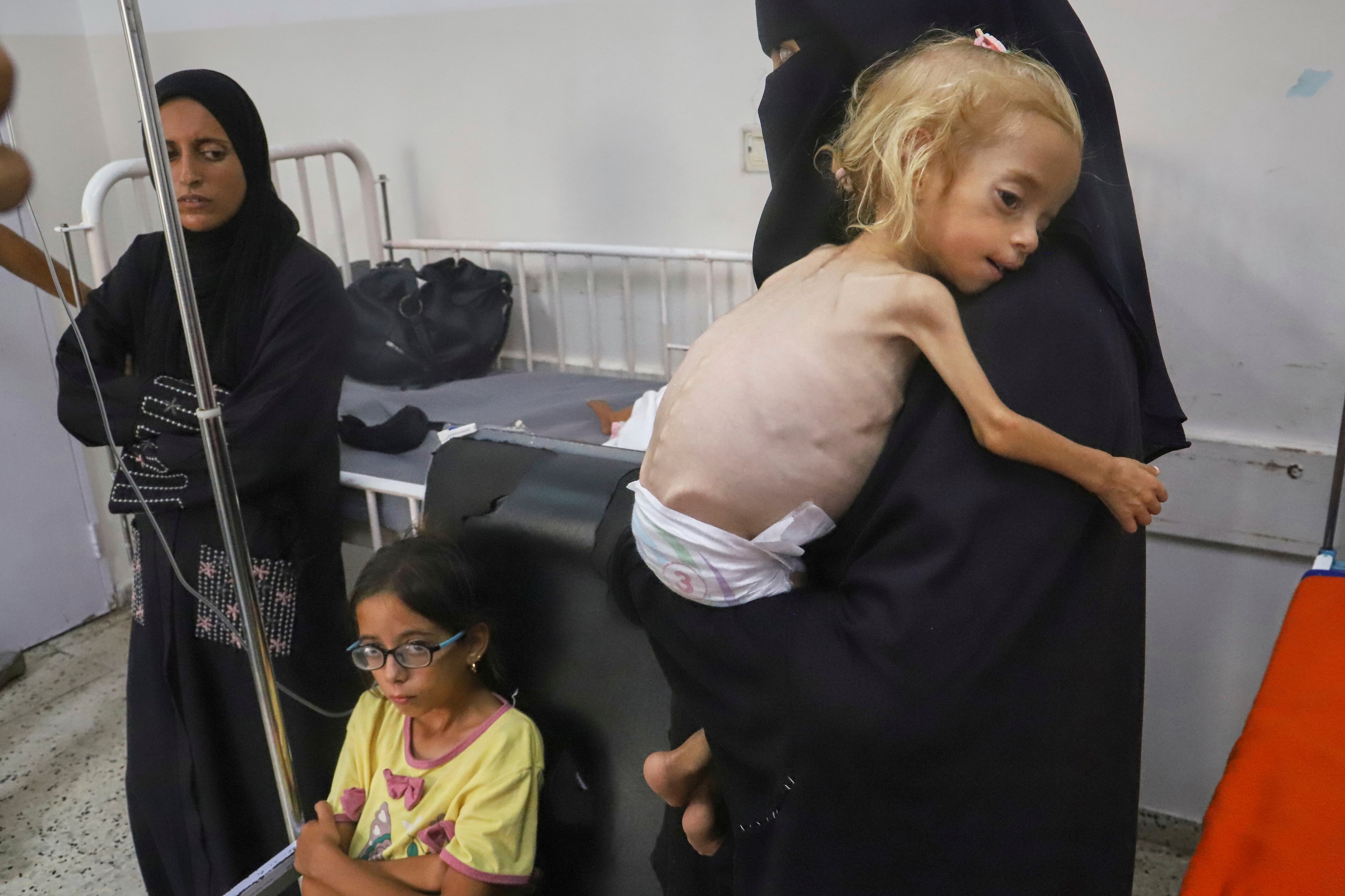 Malnourished Gaza girl with rare genetic disease recovers in Italian ...